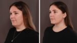 The Surprising Ways Jaw Health Affects Your Facial Aesthetics and ...